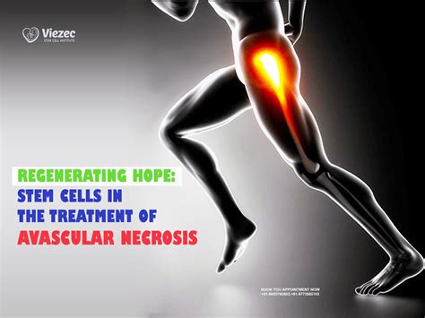 Regenerating Hope Stem Cells Treatment Of Avascular Necrosis