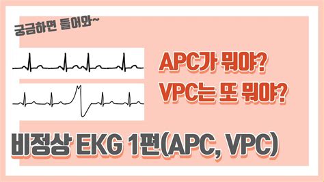 비정상 Ekg 1편 Apc Vpc 알아보기 Youtube