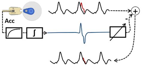 Principle Of Af Algorithm Black Is The Bioimpedance Signal Dzdt Red