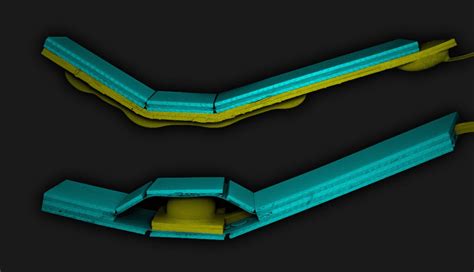 smaller smarter softer robotic arm for endoscopic surgery robohub