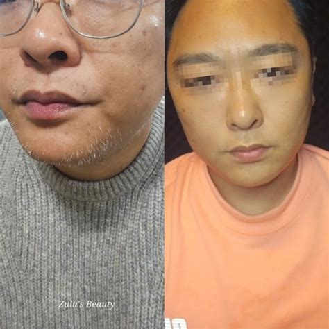 셀프왁싱 재료 워머기 기계왁스 세트 추천 남자 얼굴 수염 왁싱 후 관리까지 모엔드 키트 후기 네이버 블로그