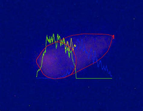 Comet Seen In Mta Fillapex Image Analysis Was Done By Imagej And Open Download Scientific