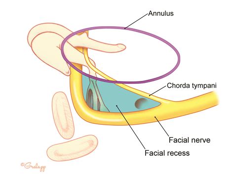 Facial Recess Approach Oto Surgery Atlas