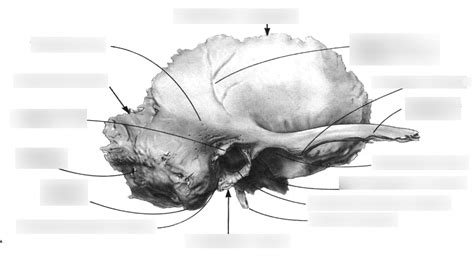 Temporal Bone Labeling Diagram Quizlet