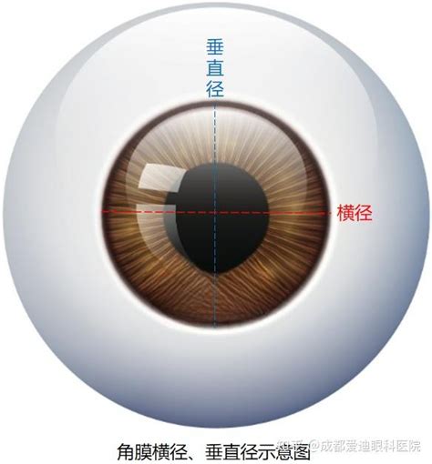 近视手术攻略 检查报告篇 知乎