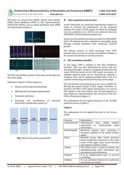 Irjet Ecg Based Cardiac Arrhythmia Detection Using A Deep Neural