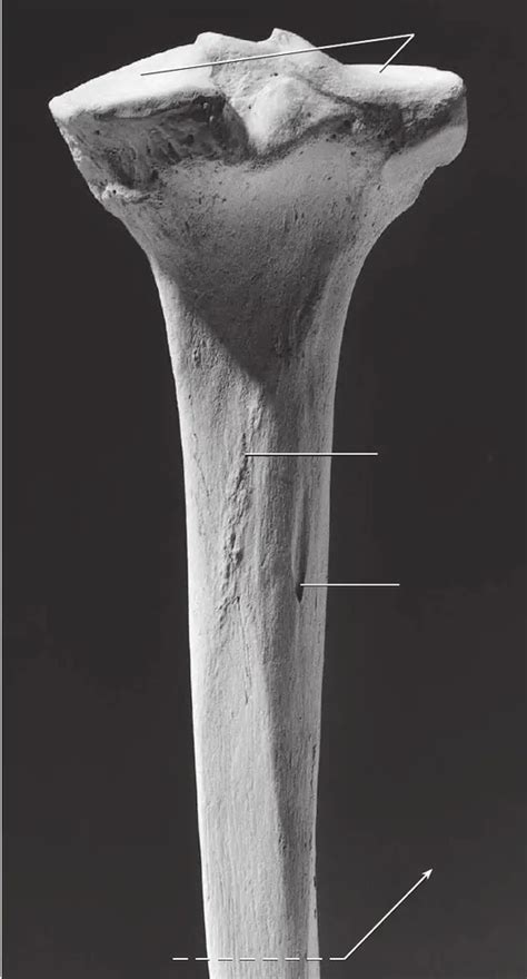 Anatomical Terminology Tibial Structures Proximal Posterior Flashcards Quizlet