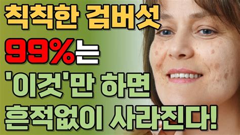 집에서 검버섯 없애는 방법 총정리 피부과에 헛돈 쓰지마세요 따라만 하면 검버섯 기미 번지지 않고 싹 다 사라집니다 [검버섯 기미 노화 피부 건강정보