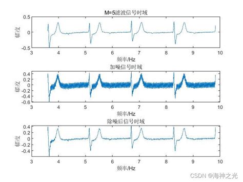 【心电信号去噪】基于matlab数字滤波器平滑滤波器心电信号滤波对比【含matlab源码 2895期】心电信号 实时卡尔曼滤波 Csdn博客