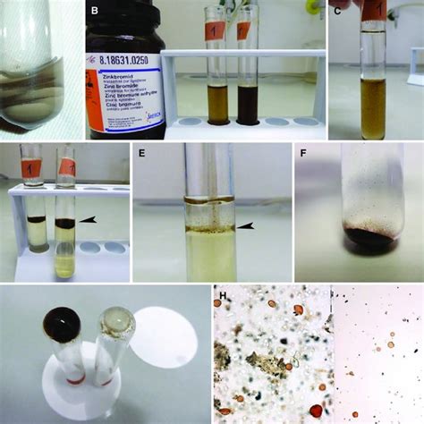 Acetolysis Treatment Chlorination A And Acetolyzation B The Two