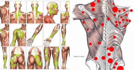 Blog What Are Trigger Points And Why Do They Matter