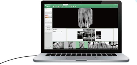 EzSensor Classic VATECH