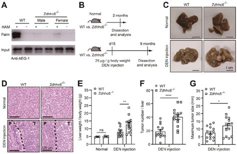 Genetic Deletion Of Zdhhc6 Exacerbates The Progression Of Den Induced