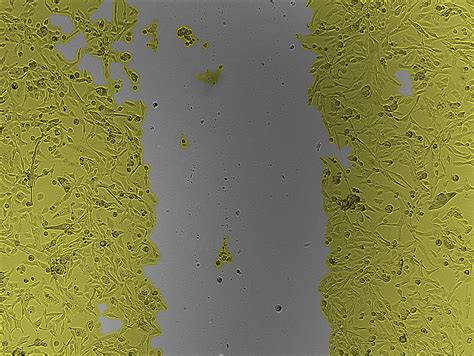 细胞划痕实验保姆级教程 知乎