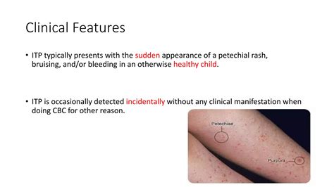Immune Thrombocytopenia Itp Pdf