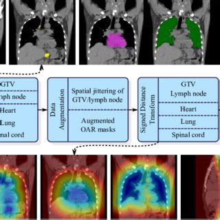 Overall Workflow Of Our Spatial Context Encoded CTV Delineation