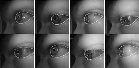 Pistol Pupil Invisible Supportive Tool To Extract Pupil Iris Eye Opening Eye Movements