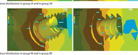 Figure 13 From Evaluation Of Stress Distribution In Implants Used To Retain Auricular Prosthesis
