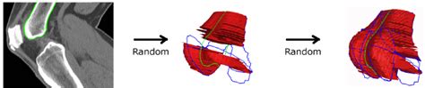 Segmentation Guided By Random Plane Suggestions Both Segmentations