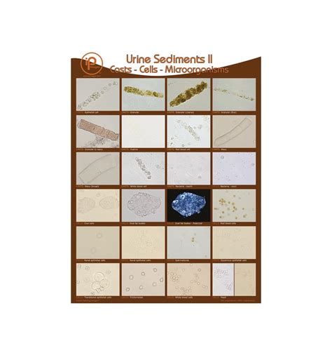 Urine Sediments Poster Medline