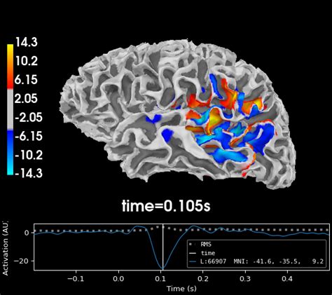 The Role Of Dipole Orientations In Distributed Source Localization