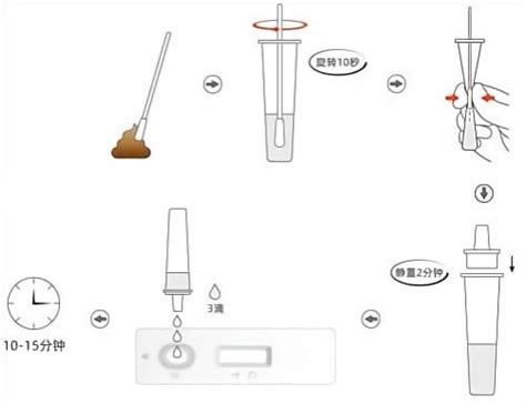 Toxoplasma Gondii Antigen Toxo Ag Test Kit