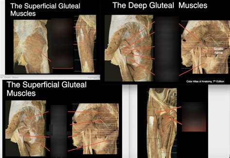 4 Gluteal Muscles Superficial And Deep Diagram Quizlet