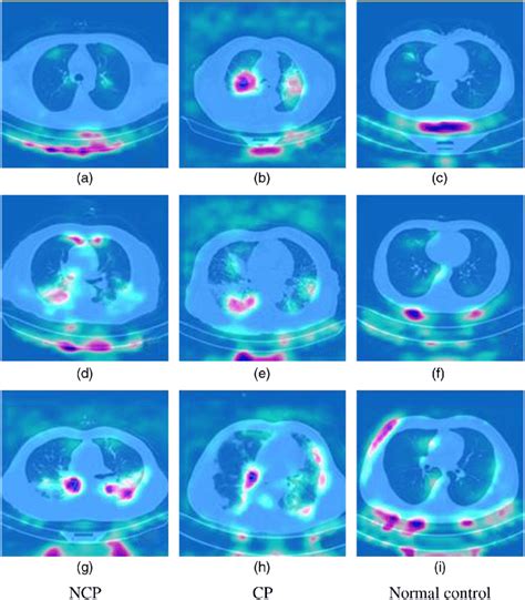 saliency maps of the smooth grad cam algorithm a d g the
