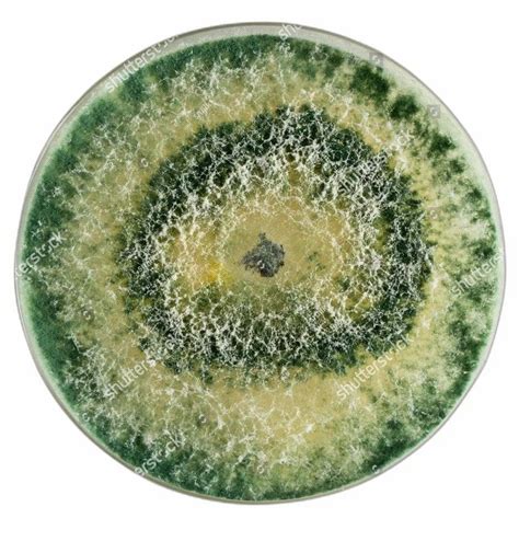 Trichoderma Spp At Best Price In Hyderabad By Shivashakti Bio