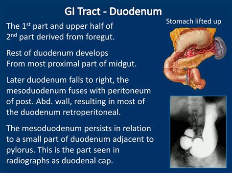 Anatomy Of Duodenum Duodenum Structure Ppt Of Duodenum Power Point Presentation Duodenum Pptx