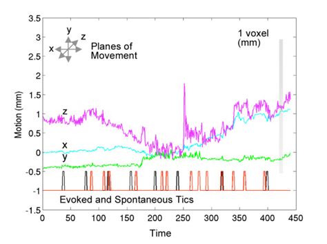 Evaluation Of Motion During Fmri Acquisition Estimated Translations Download Scientific