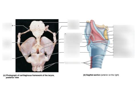 Sagittal And Posterior View Of Larynx Diagram Quizlet