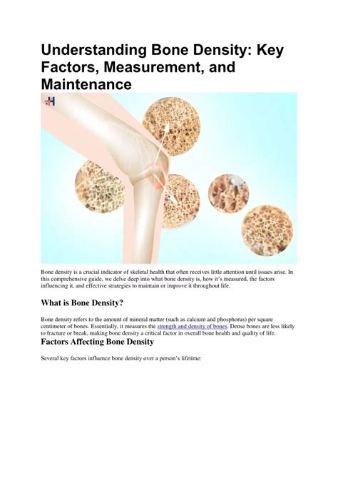 PPT Understanding Bone Density PowerPoint Presentation Free Download ID