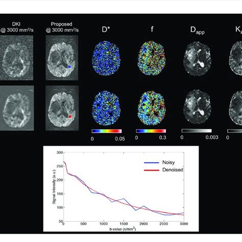 effect of the denoising algorithm on the images and signal the