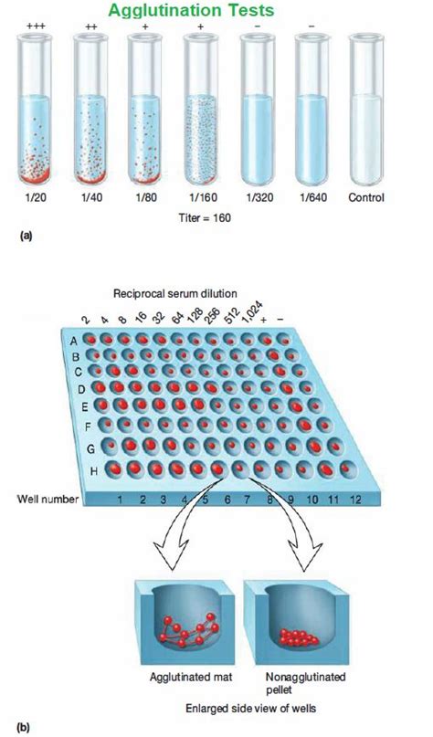 Bacterial Agglutination Test Principle At Sandra Mcgregor Blog