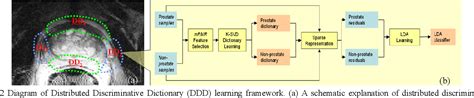 Figure 1 From Mr Prostate Segmentation Via Distributed Discriminative Dictionary Ddd Learning