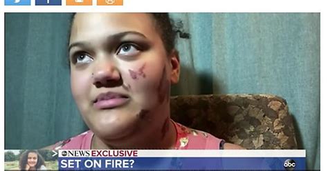 Alleged Hate Crime Was A Hoax Album On Imgur