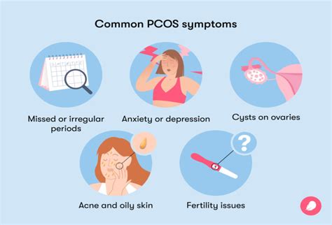 Polycystic Ovary Syndrome Pcos Among Young Girls In India Upsc