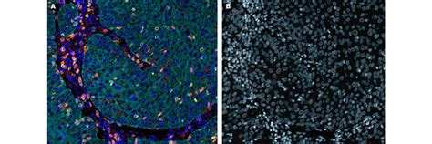 the integration of deep learning methods to improve nuclei detection and segmentation — oraclebio