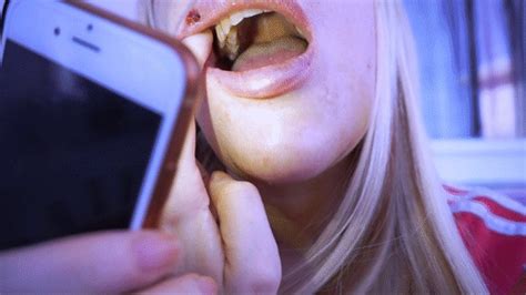 Mouth Exploration After My Surgery Ldb Mistress Clips Sale