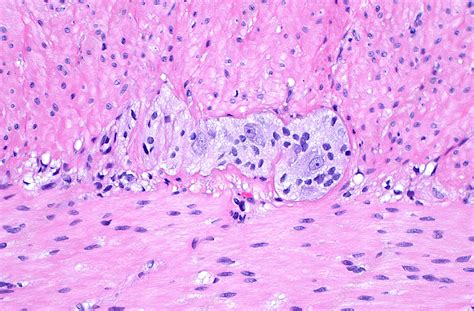 Myenteric Nerve Plexus Cells Light Micrograph Stock Image C058 1148 Science Photo Library