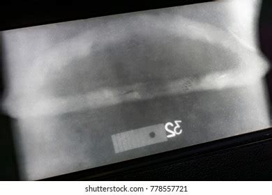 Defectoscopy Images Stock Photos Vectors Shutterstock