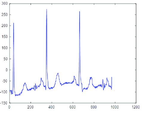 Original Ecg Signal Before Compression Download Scientific Diagram