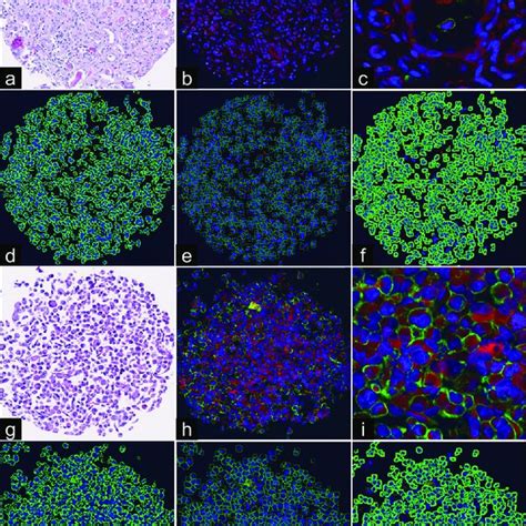 Segmentation Of Fluorescence Digital Tissue Images Slides Were Scanned Download Scientific