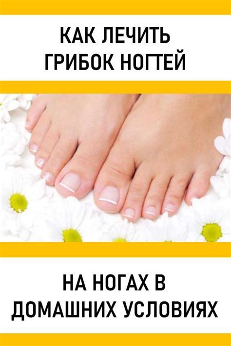 Как лечить грибок ногтей на ногах в домашних условиях Грибок ногтей м 👧👜 ЖЕНСКАЯ МОДА 👛👩