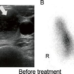 Technetium M MTc Pertechnetate Thyroid Scan The MTc Download Scientific Diagram