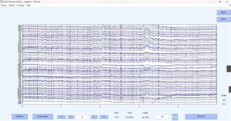 Eeglab处理运动想象脑电数据 Csdn博客 Eeglab处理运动想象脑电数据 Csdn博客