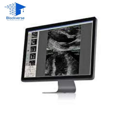 Pacs Software At Best Price In Jaipur By Blockverse Infotech Solutions