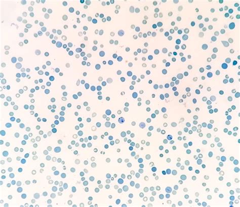 Premium Photo Close View Of Reticulocyte Count Under Microscope Methylene Blue Staining