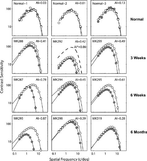 Spatial Contrast Sensitivity Functions Of 3 Normal Top Row And Download Scientific Diagram